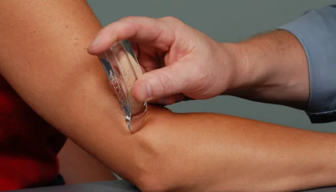 ASTYM In Germantown, MD | Orthopedic Manual Therapy Specialists